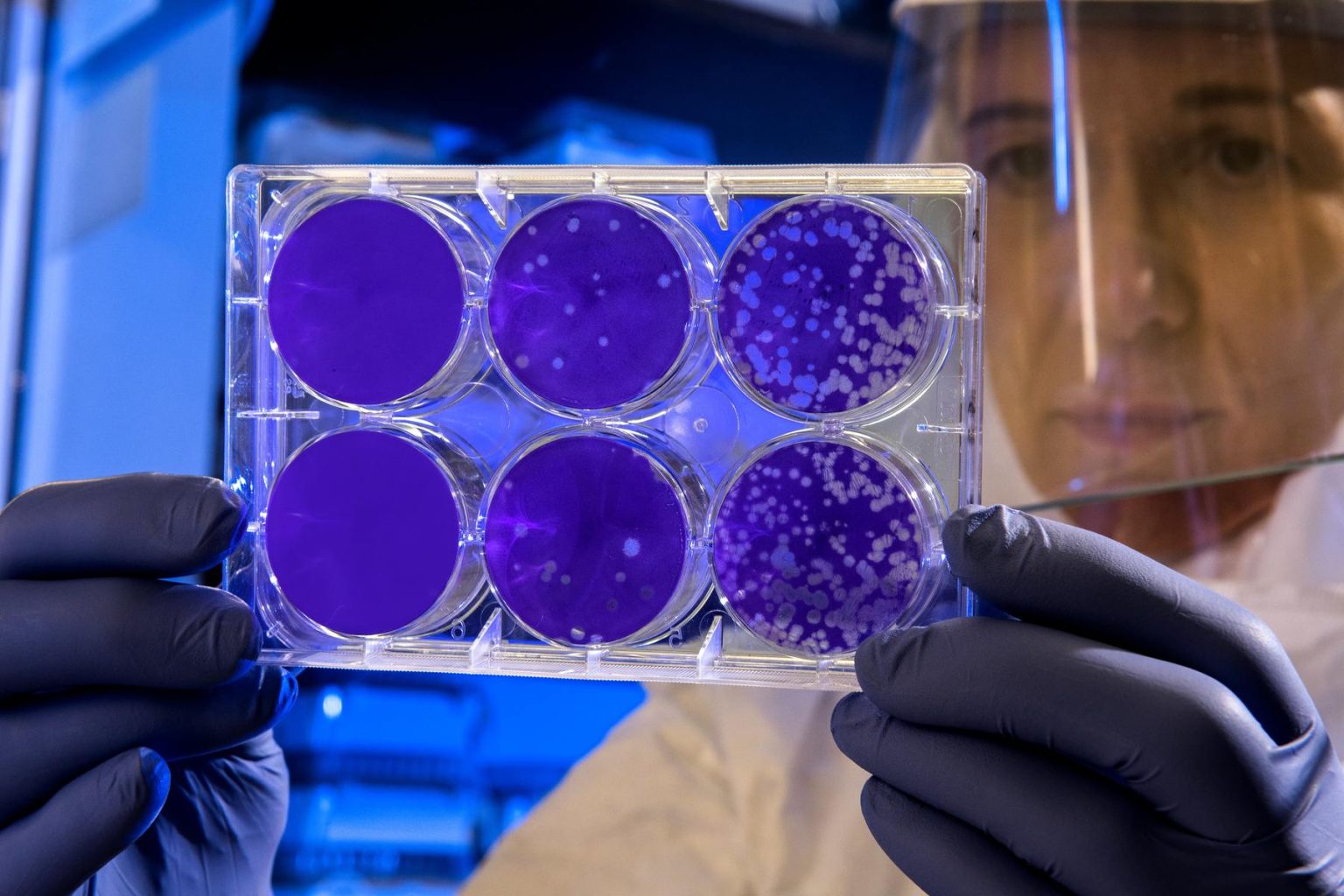 Microbial Forensics: A Tool Used in Forensic Investigation - Legal ...
