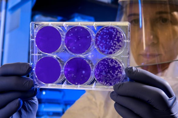 Microbial Forensics: A Tool Used in Forensic Investigation - Legal ...